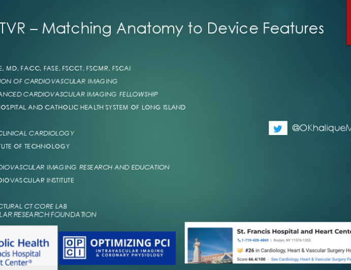 CT Imaging for Transcatheter Tricuspid Valve Replacement: Matching ...